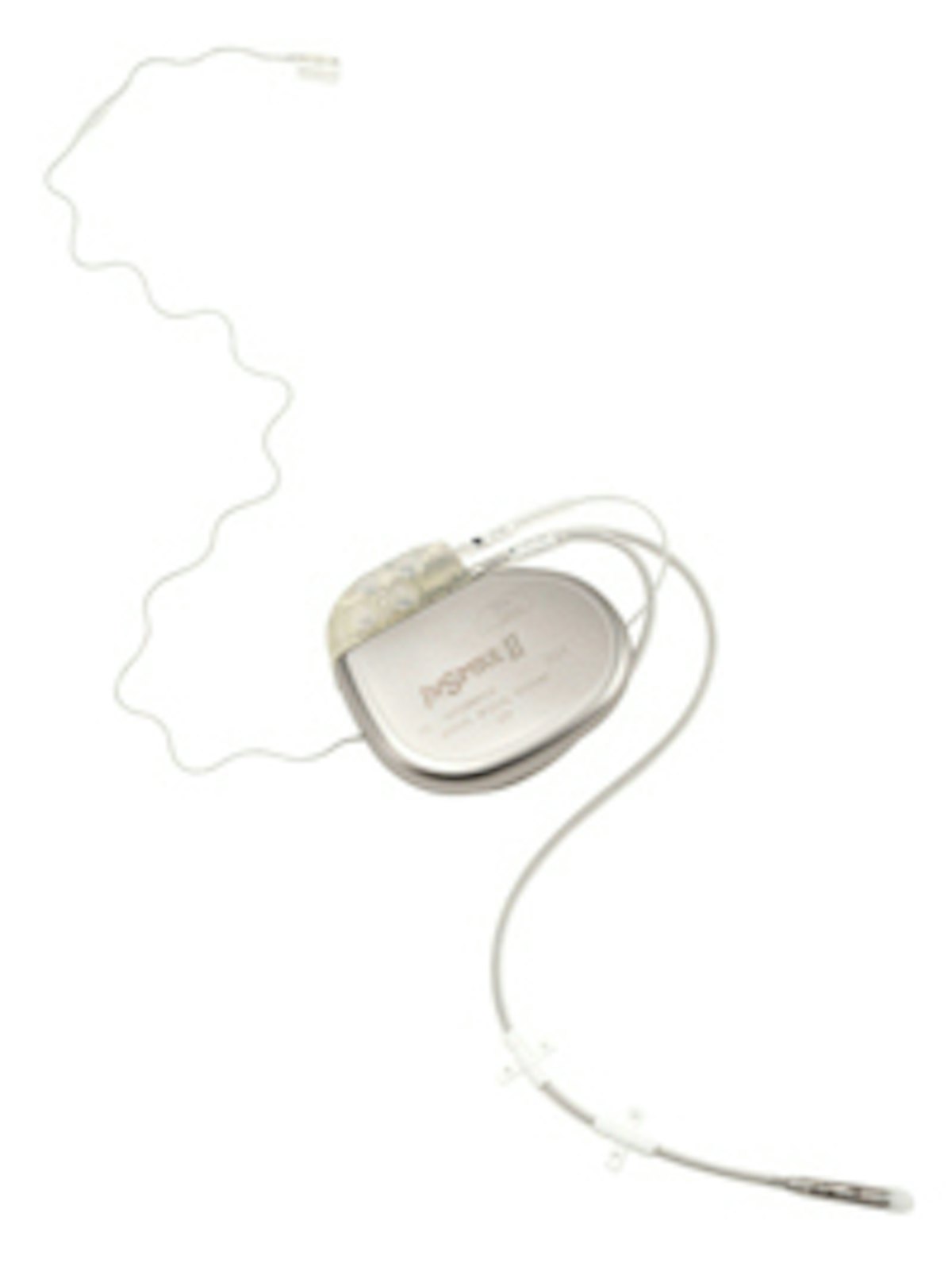 Sleep apnea implant device in clinical trials | DrBicuspid.com