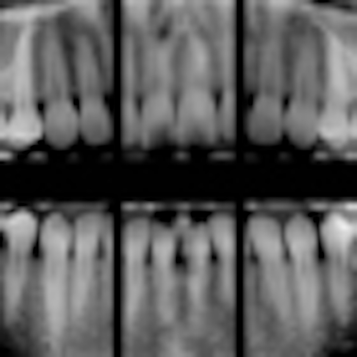 Pediatric dose study supports rectangular collimation | DrBicuspid.com