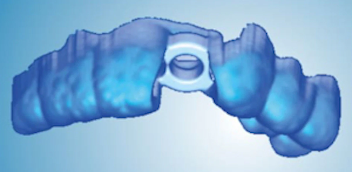 New product: Planmeca adds implant guide module | DrBicuspid.com