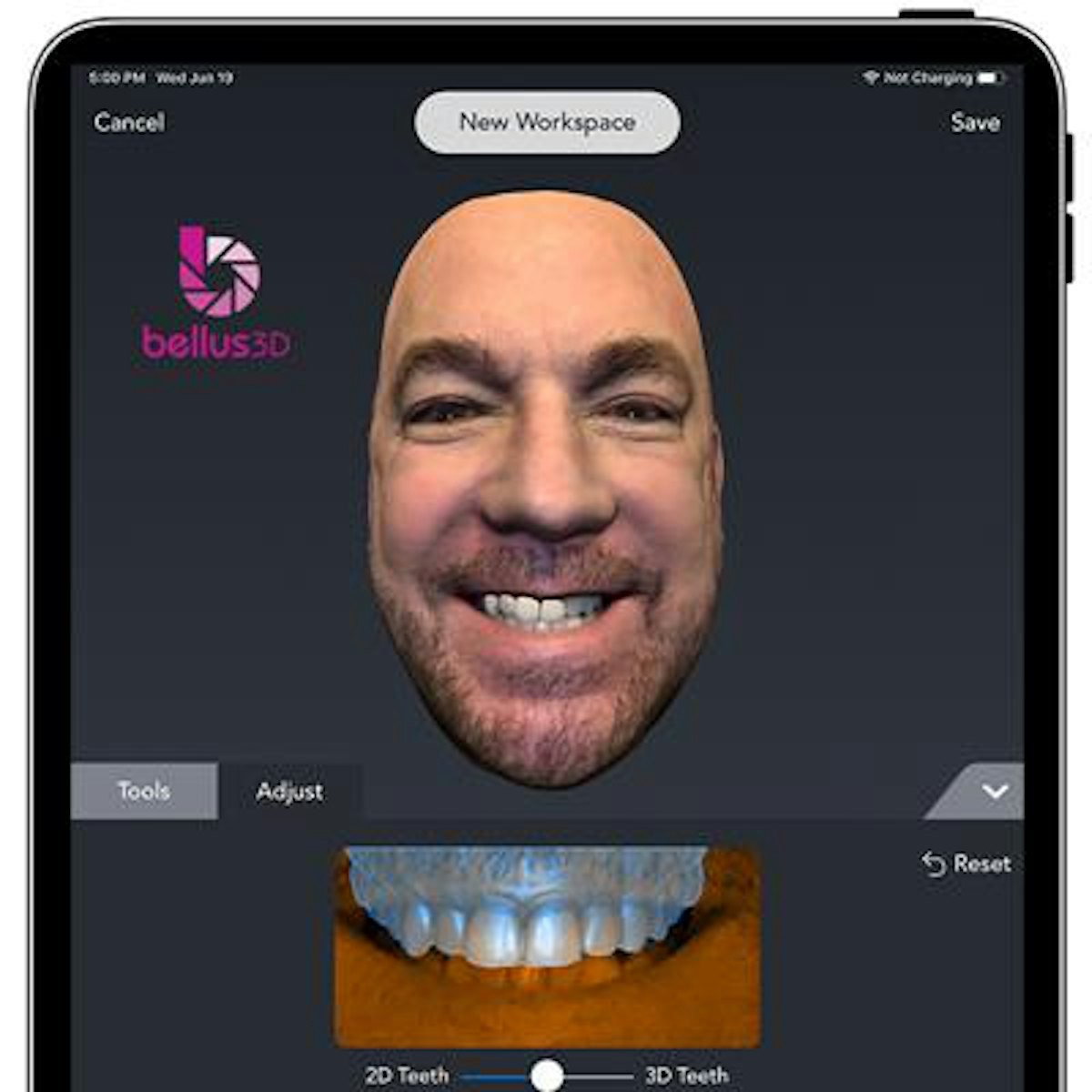 Bellus3D app to merge intraoral, face scans | DrBicuspid.com