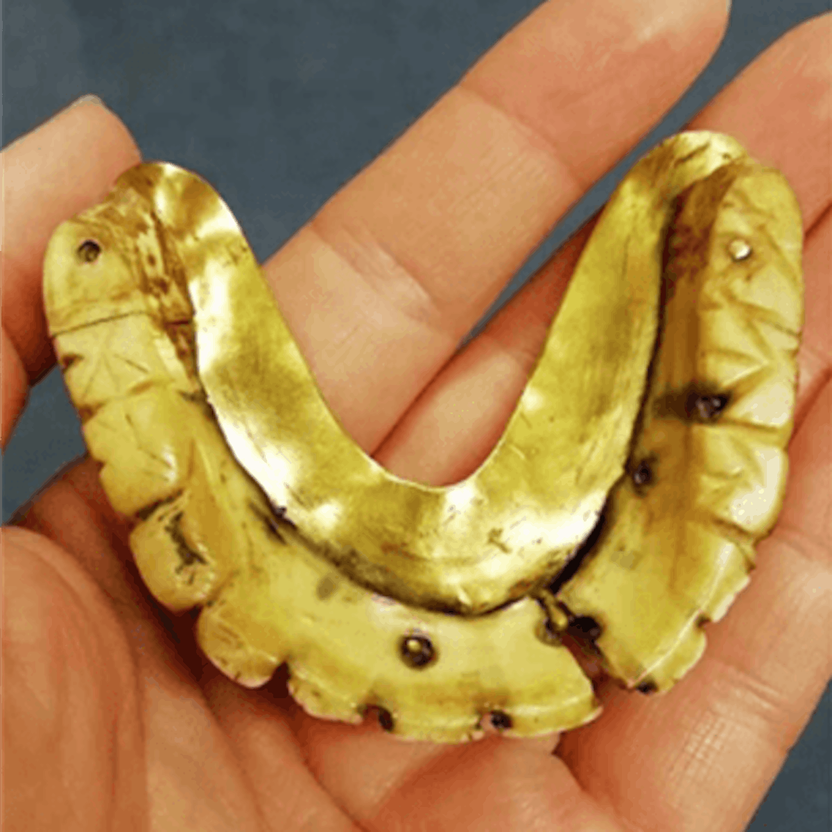 Gold, ivory false teeth from 1800s valued at $9K for sale | DrBicuspid.com