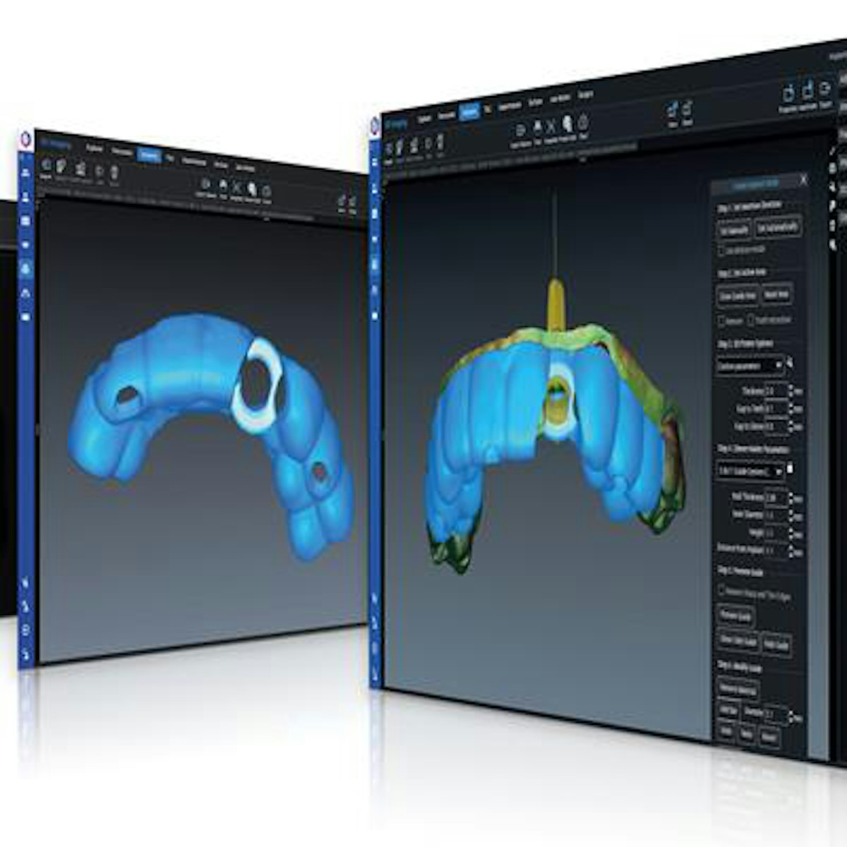 Planmeca USA launches redesigned Planmeca Romexis | DrBicuspid.com