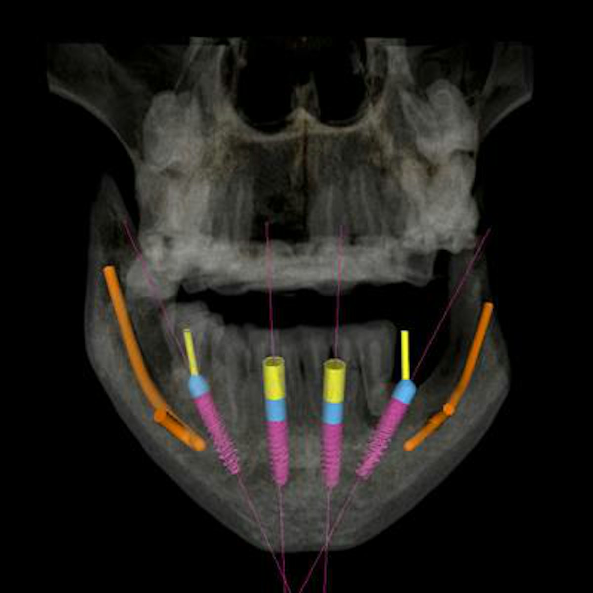 Why it's time to consider CBCT in your practice | DrBicuspid.com