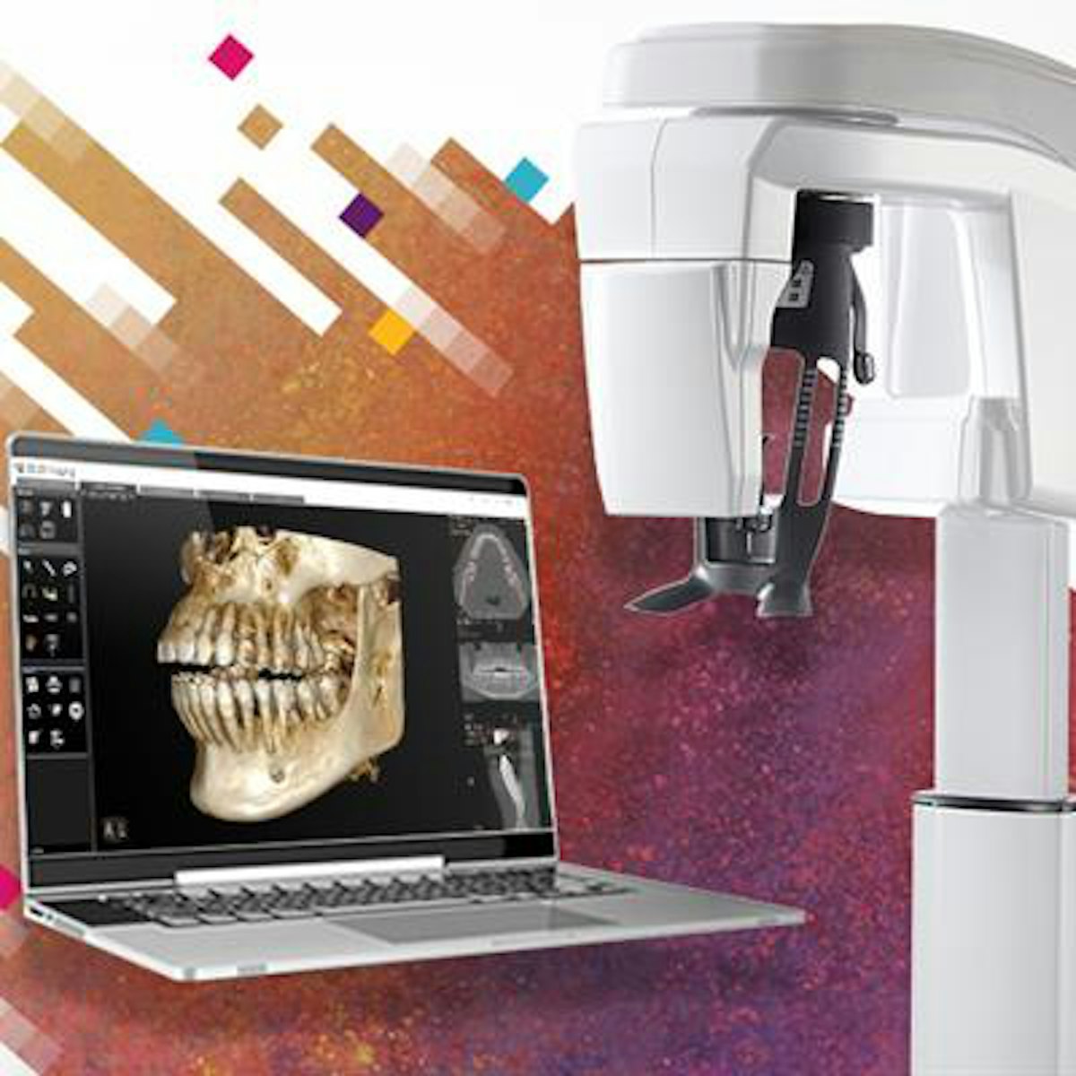 Carestream unveils new imaging system line | DrBicuspid.com