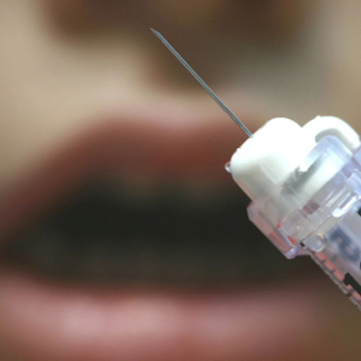 Needle sticks, burs cause most dental school injuries | DrBicuspid.com