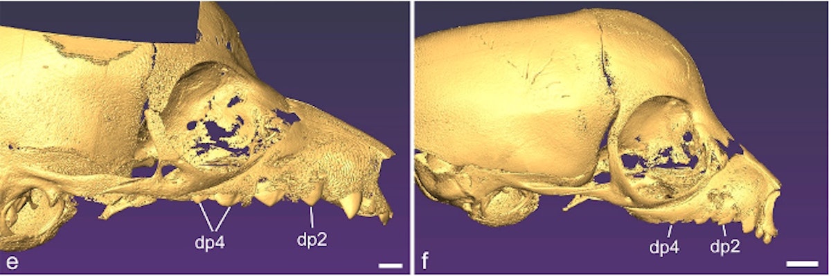 how tooth formation affects face shape | DrBicuspid.com
