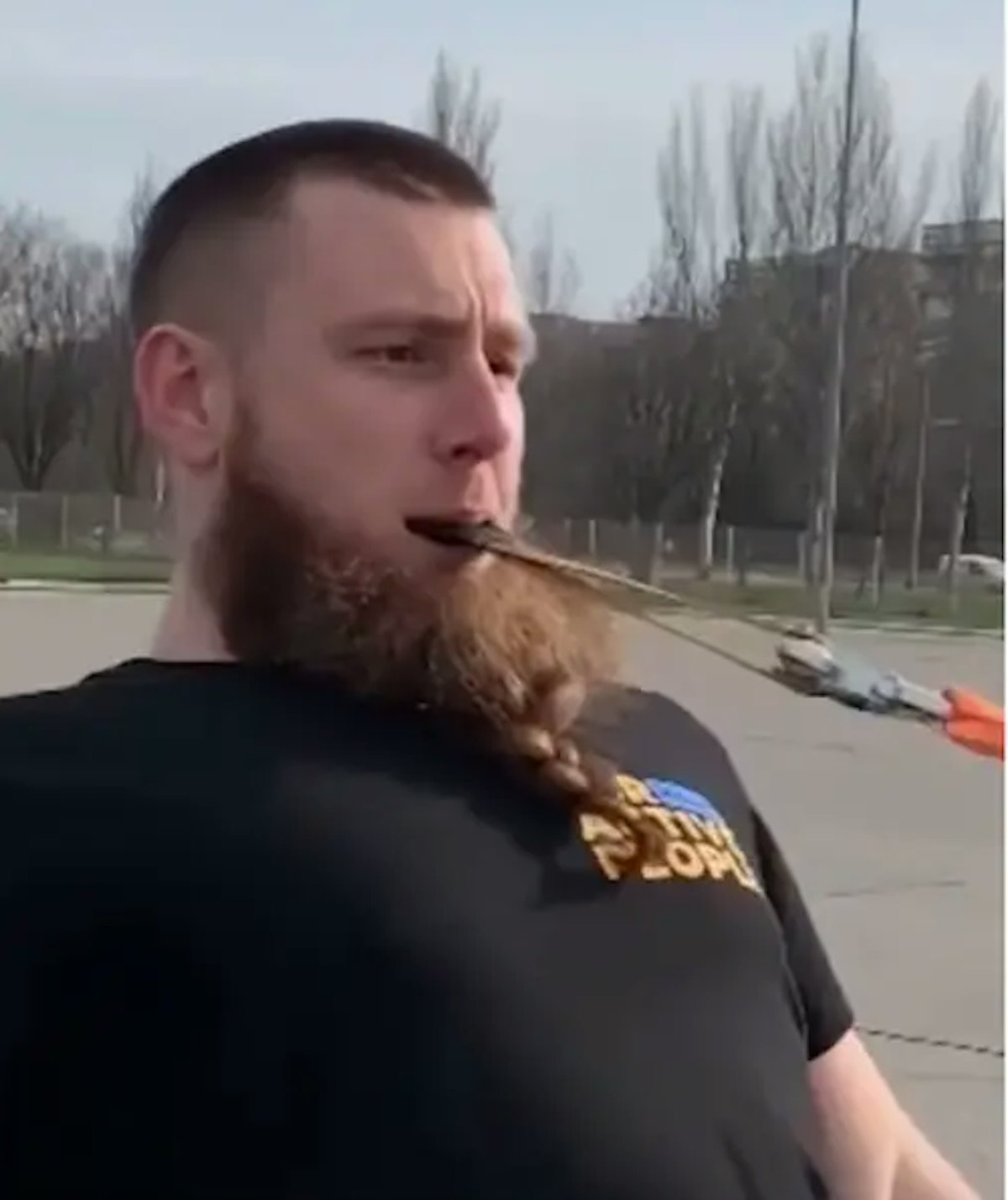 Ukrainian breaks record (not teeth) pulling 6 cars | DrBicuspid.com