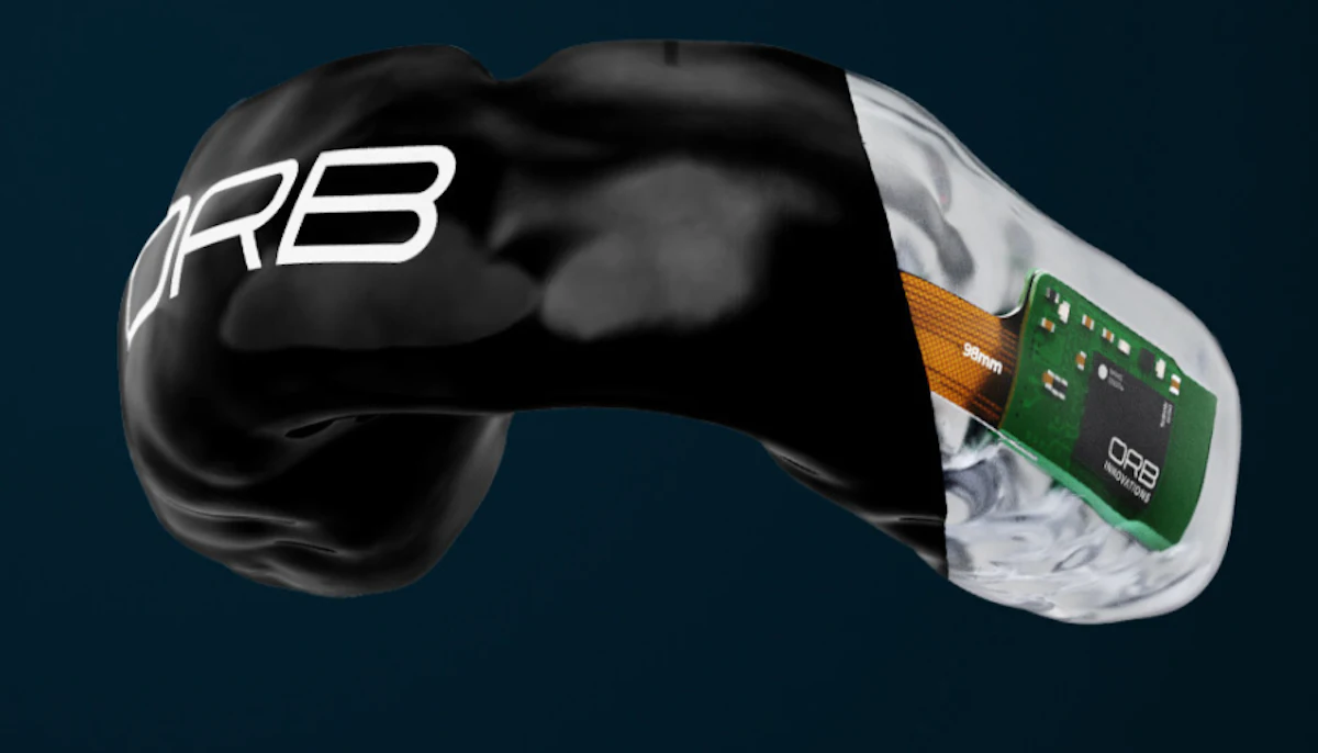ORB launches smart mouthguard | DrBicuspid.com