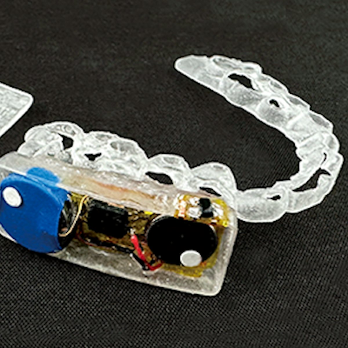 'OK, Google,' when is a retainer also a smart device? | DrBicuspid.com