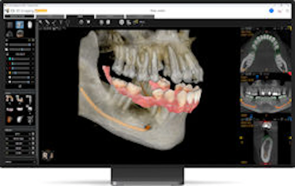 Carestream Dental launches AI-powered software | DrBicuspid.com